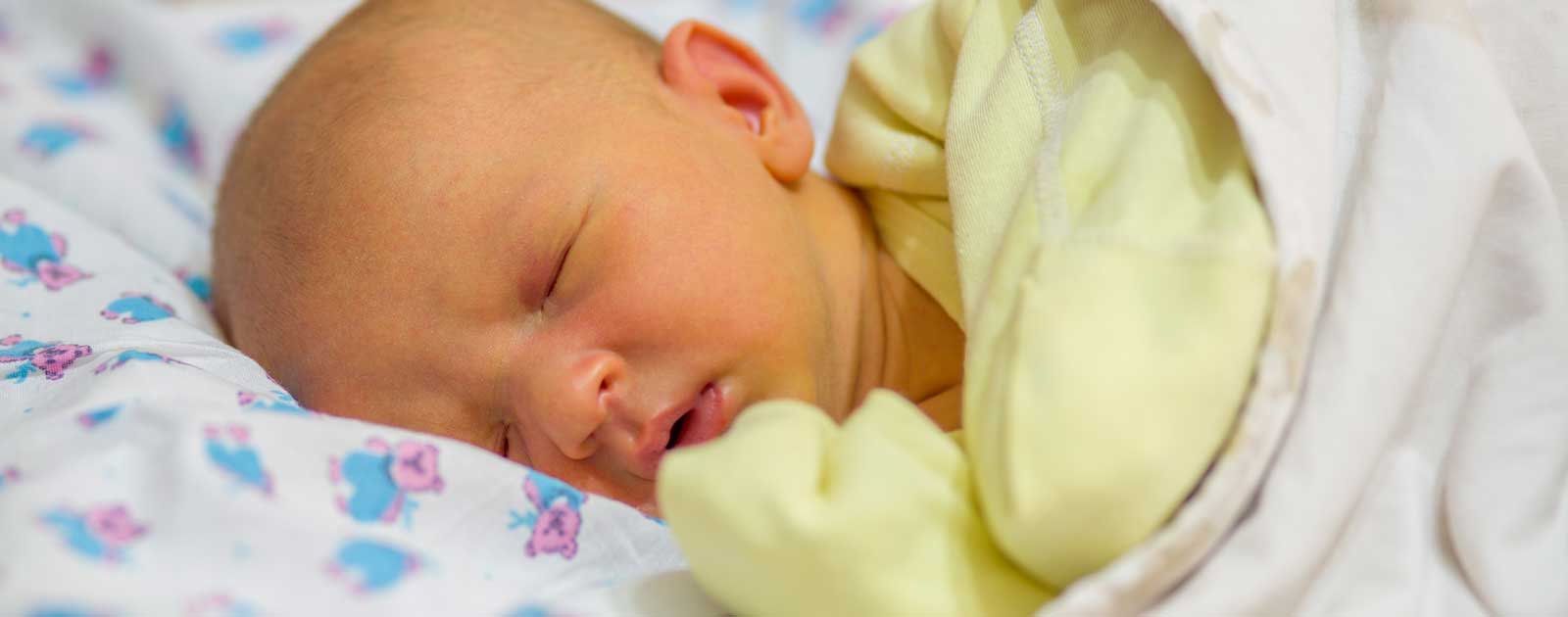 Icterícia: saiba o que é e quais os tratamentos