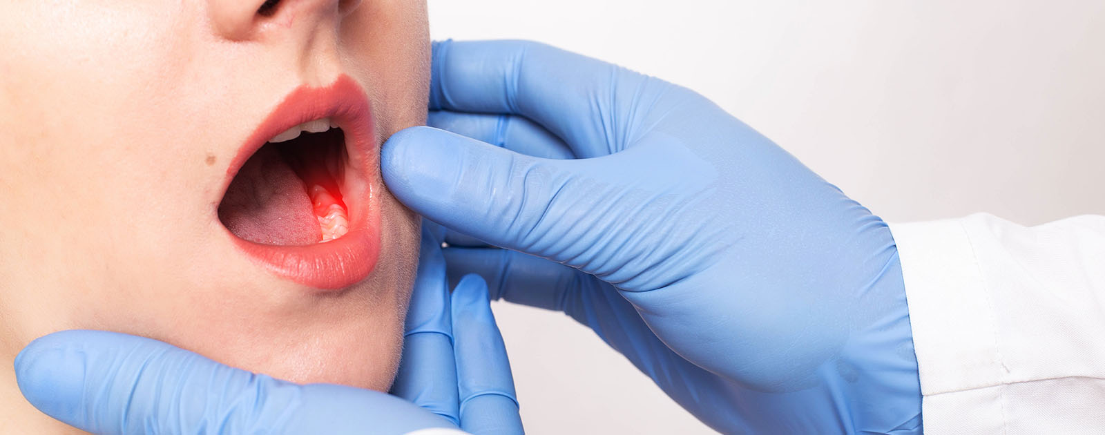 Pulpite: descubra como tratar a inflamação da polpa dentária